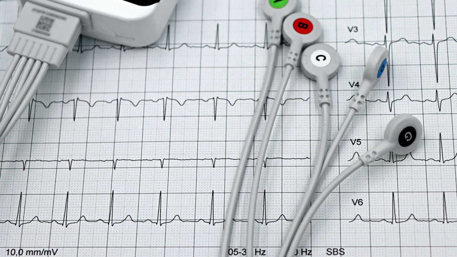 Understanding the ECG Procedure for Heart Health Monitoring - Salus ...